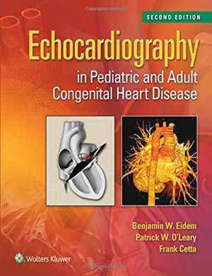 [PDF] دانلود کتاب Echocardiography In Pediatric And Adult Congenital Heart Disease, 2nd ed, 2014